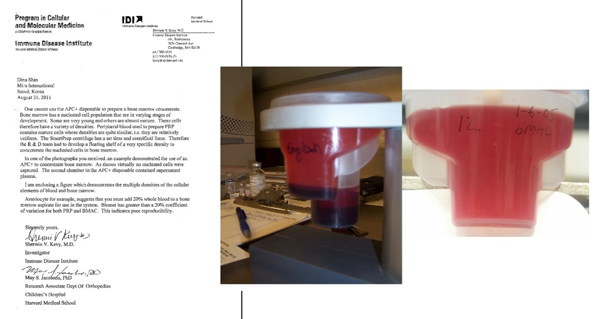 No Nucleated Cells Found in Bone Marrow Extraction Using Blood Kit for ...